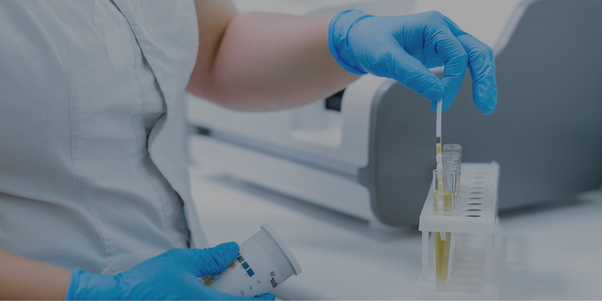 How to Test Urine for UTIs using PCR – Filtrous