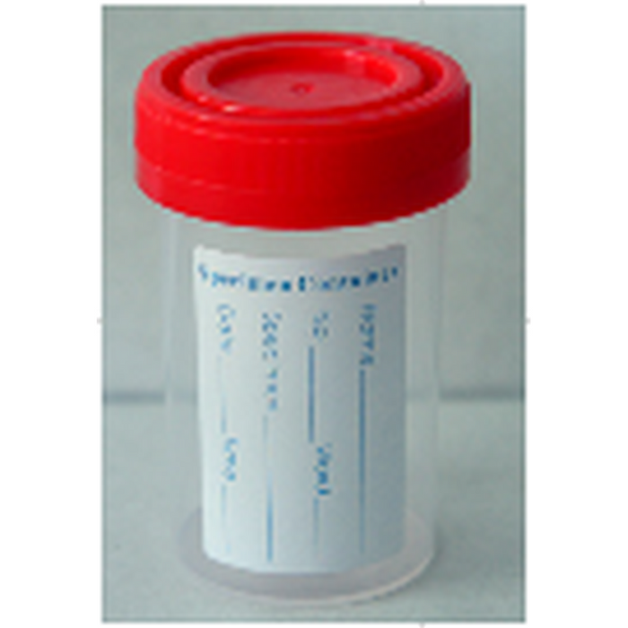 61 mL Urine Collection Containers, Sterility EO, 200/ unit